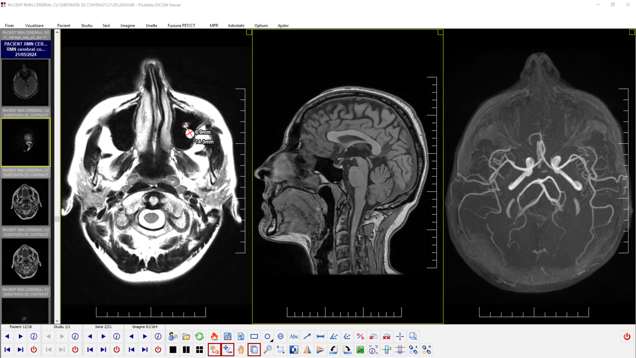 Viewer 2D | PixelData