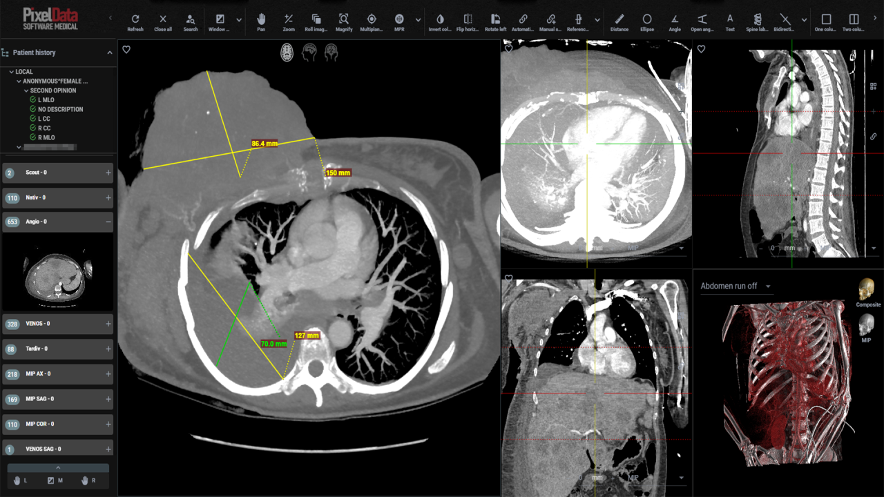 Viewer 3D Web | PixelData
